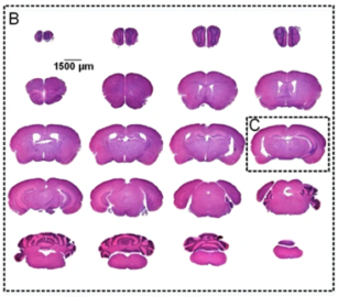 A Colorful Journey with Hematoxylin and Eosin Staining - GloNeuro